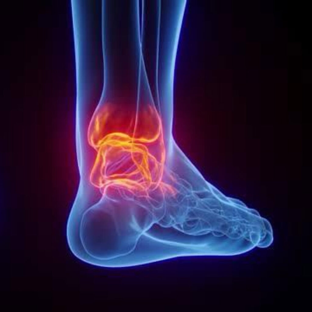 tendinitis-mpc